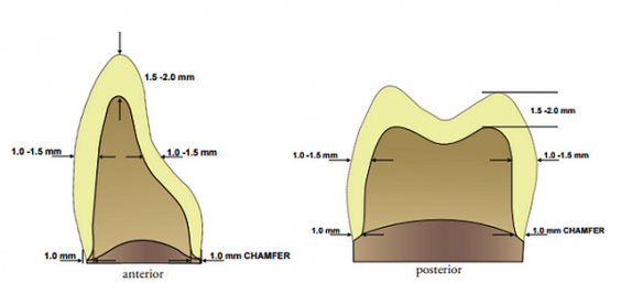 Brušenje zuba za cirkonij – oksidnu keramiku